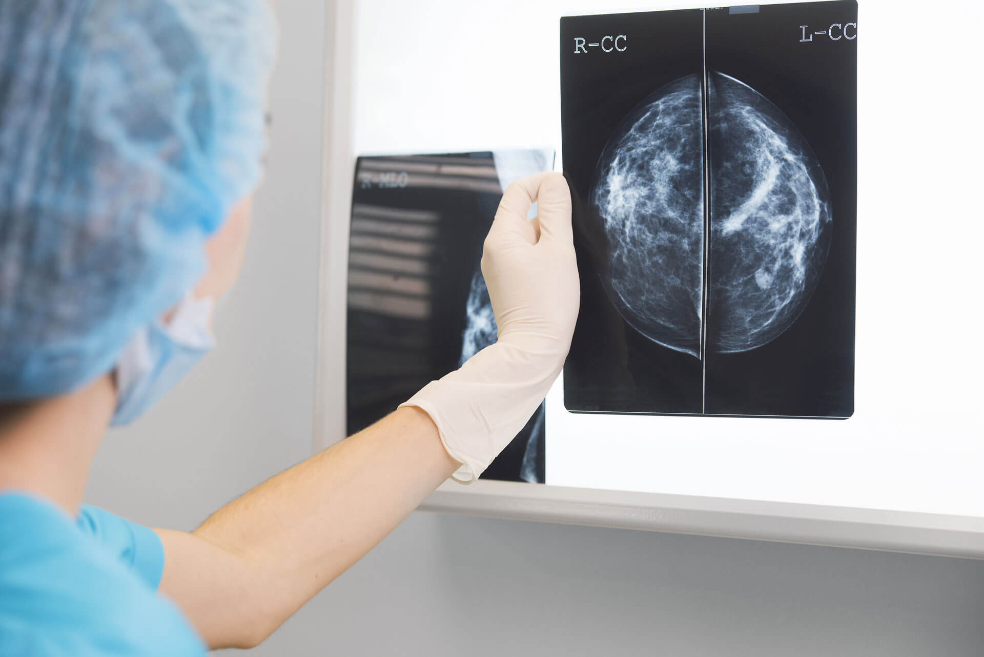 What is a Mammogram? - Total Care Primary Care